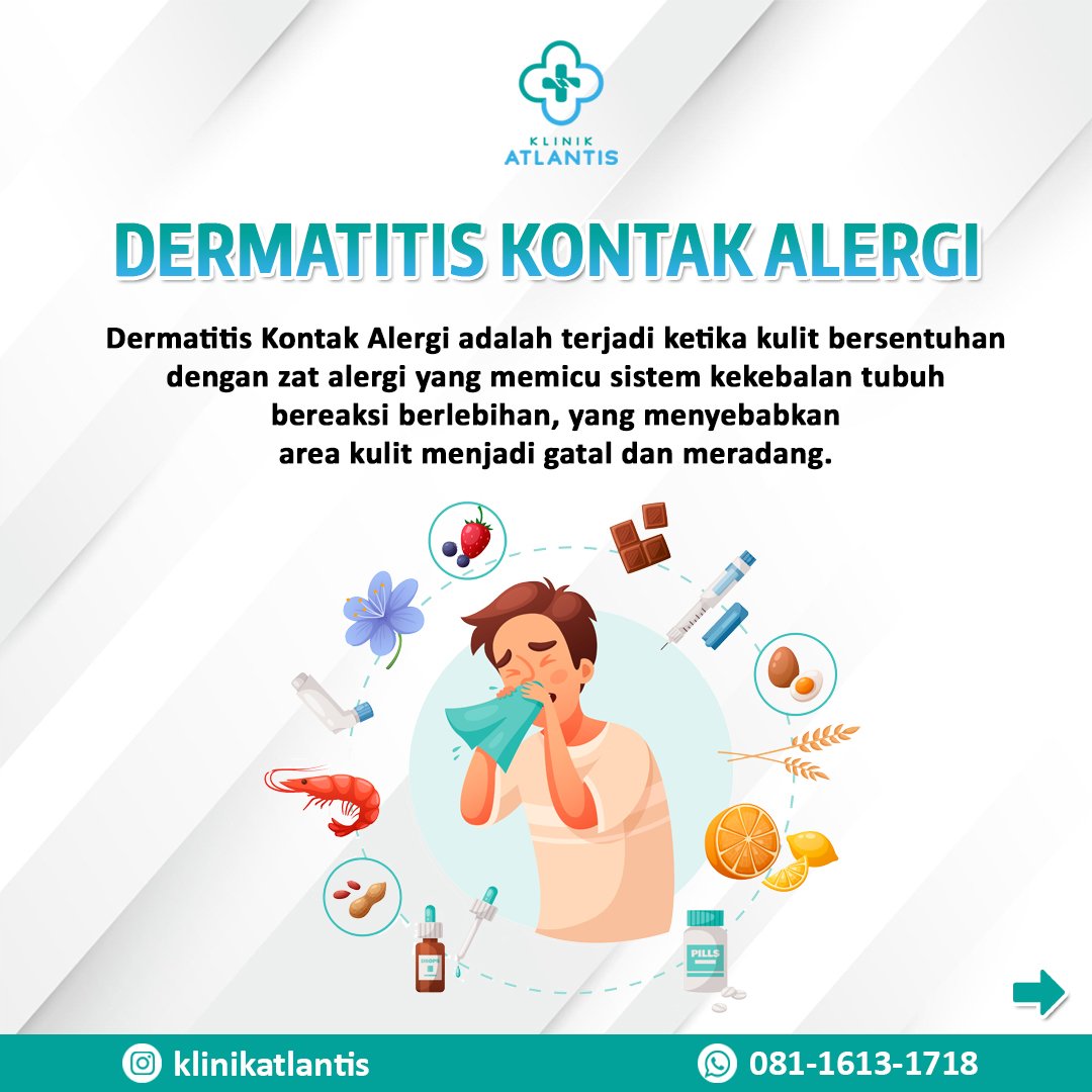 DERMATITIS KONTAK ALERGI - Klinik Atlantis